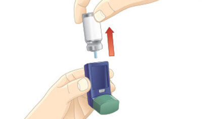 LUPIN | Albuterol Inhaler Help and Support