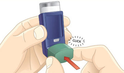 LUPIN | Albuterol Inhaler Help and Support