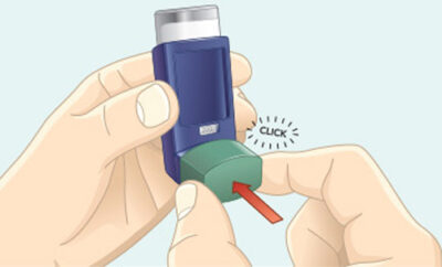 LUPIN | Albuterol Inhaler Help and Support
