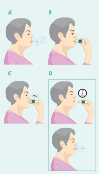 LUPIN | Tiotropium Bromide Inhalation Powder Capsule