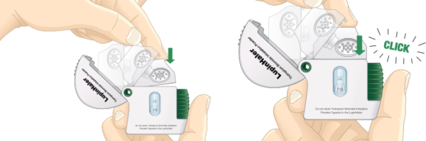 LUPIN | Tiotropium Bromide Inhalation Powder Capsule